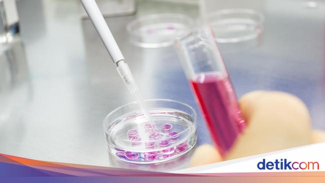 Ketahui Jenis-Jenis Sampling Agar Tak Salah saat Penelitian