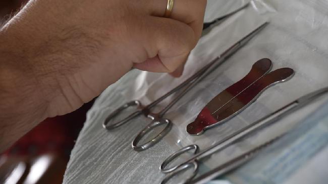 Kata Dokter soal Bahaya Sunat Model Jengger Ayam, Bunda Perlu Tahu