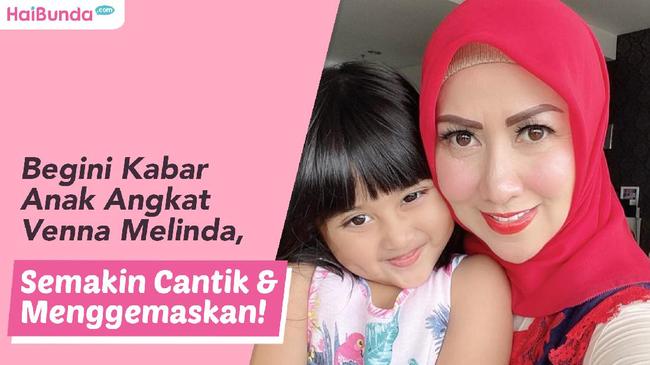 Begini Kabar Anak Angkat Venna Melinda, Semakin Cantik & Menggemaskan!