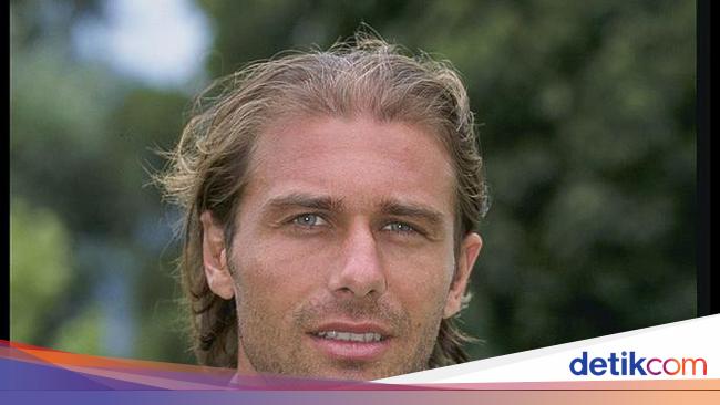 Conte Botak Dini, Kini Gondrong Lagi... Transplantasi adalah Kunci!