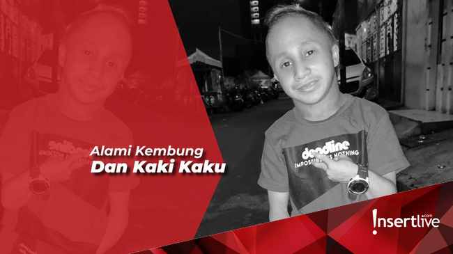 Dicky Topan 'Si Entong' Meninggal Dunia Akibat Pembengkakan Jantung