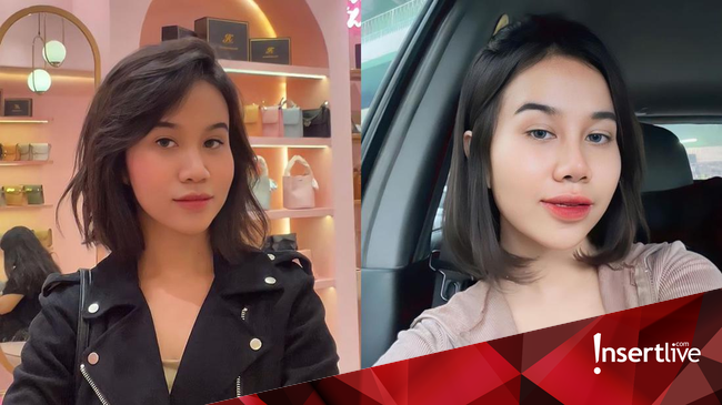 Potret Before-After Mayang Operasi Plastik Kini Disebut Makin Glowing