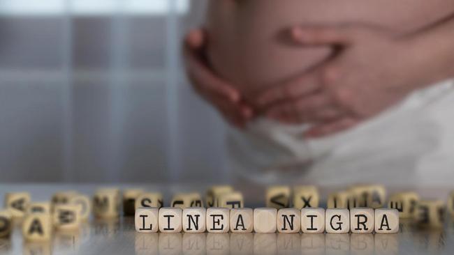 Mengenal Linea Nigra, Garis Hitam pada Ibu Hamil