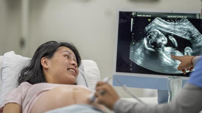 Berapa Ukuran Normal Hasil USG Janin? Ini Faktanya