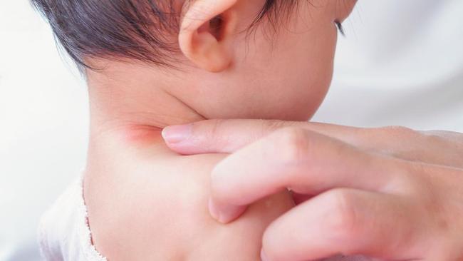 Benjolan di Leher Bayi: Kenali Penyebab dan Cara Mengatasinya