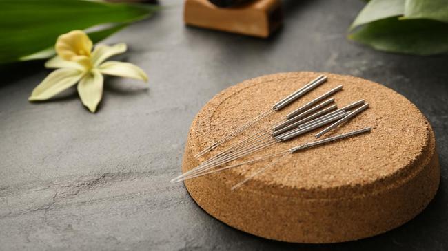 Akupunktur Bisa untuk Menangani Obesitas, Begini Caranya Bun