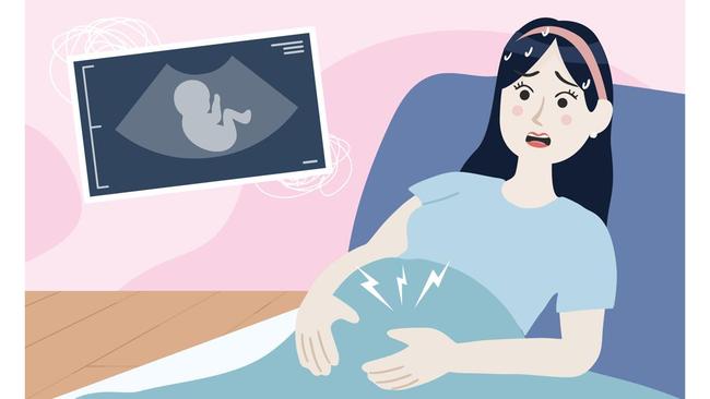 Komplikasi Persalinan: Pengertian, Jenis & Penjelasan Dokter