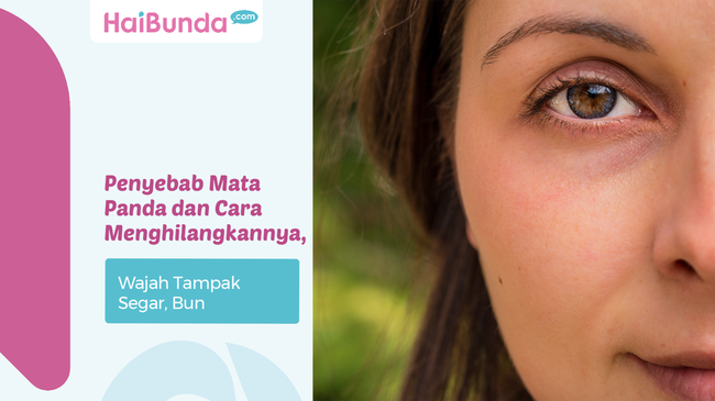 Penyebab Mata Panda dan Cara Menghilangkannya, Wajah Tampak Segar Bun