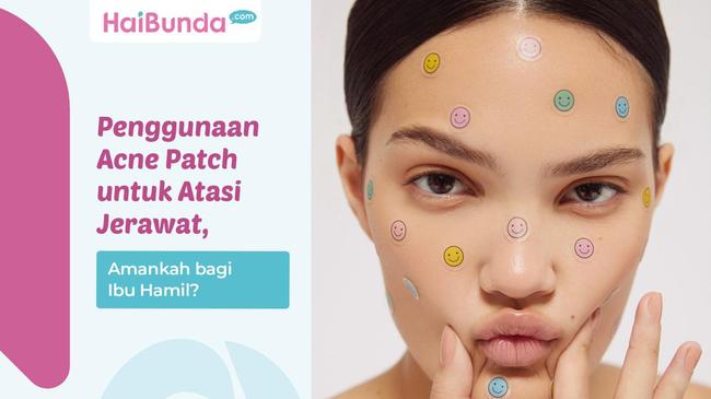 Penggunaan Acne Patch untuk Atasi Jerawat, Amankah bagi Ibu Hamil?