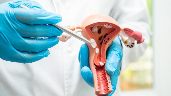 7 Ciri-ciri Gejala Rahim Retrofleksi atau Terbalik, Bunda Perlu Tahu