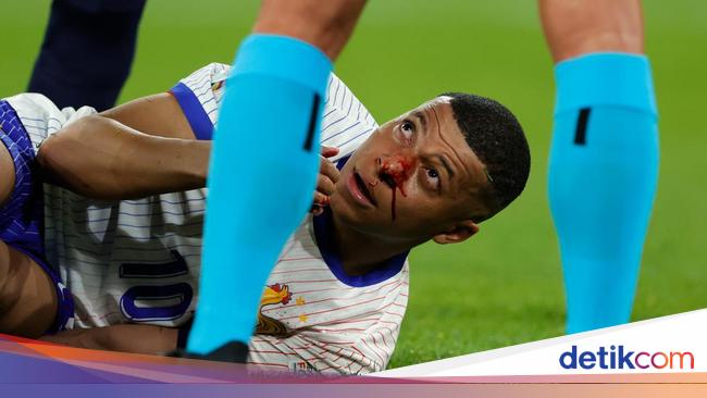 Hidungnya Patah, Mbappe Absen di Sisa Laga Fase Grup?