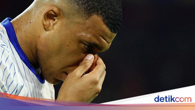 Euro 2024: Mbappe Akan Jalani Operasi karena Patah Hidung