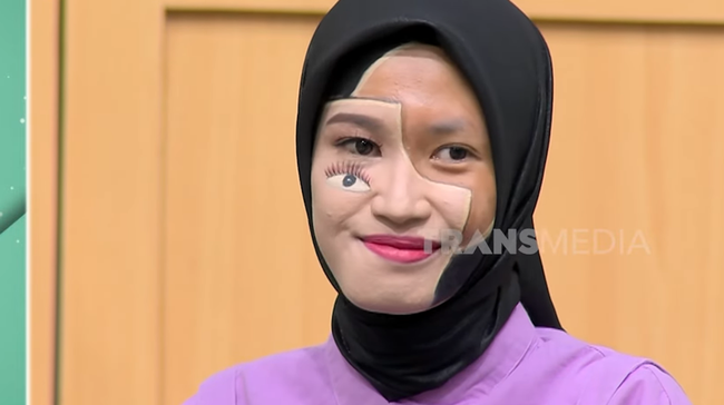 Kisah Inspiratif Arih, Alami Disabilitas Usai Ditabrak Truk Kini Sukses ...