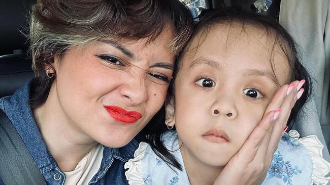 Alami Clubfoot dan LLD, Ziona Putri Bungsu Joanna Alexandra Harus ...