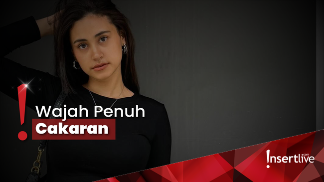 Selebgram Afifah Riyad Unggah Wajah Babak Belur di-KDRT Suami