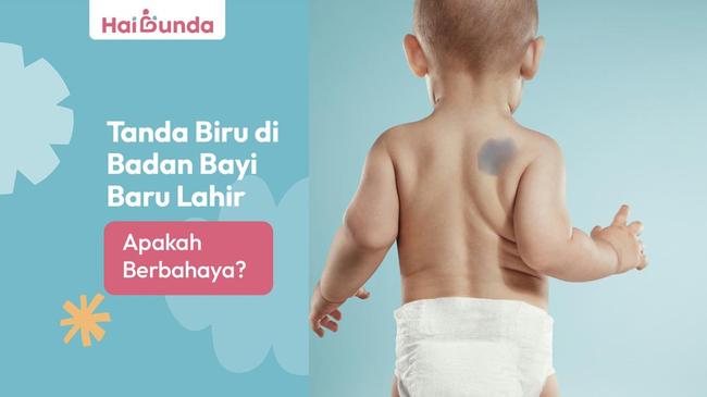 Tanda Biru di Badan Bayi Baru Lahir, Apakah Berbahaya?