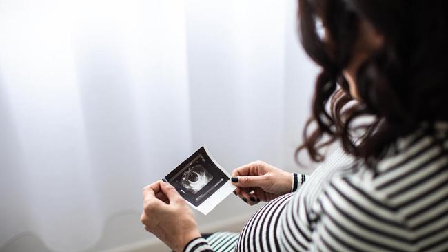 Pasangan Ini Putuskan Berpisah usai Jalani Program IVF, Bagaimana Hak ...