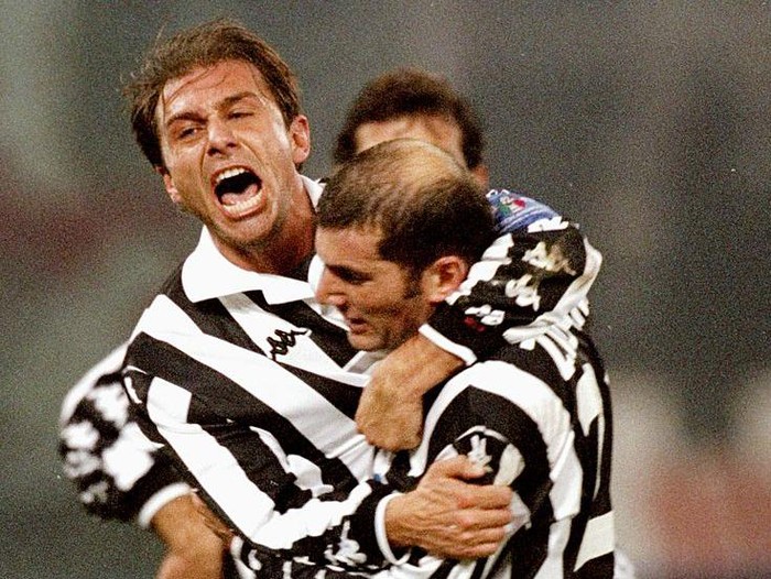 Conte Botak Dini, Kini Gondrong Lagi... Transplantasi adalah Kunci!