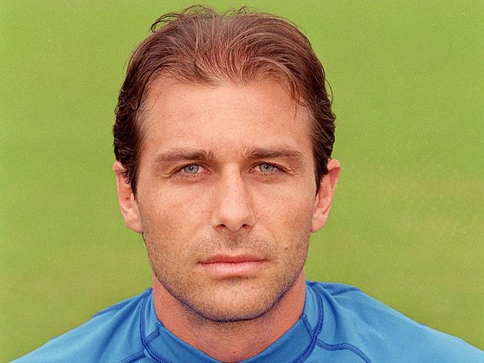 Conte Botak Dini, Kini Gondrong Lagi... Transplantasi adalah Kunci!