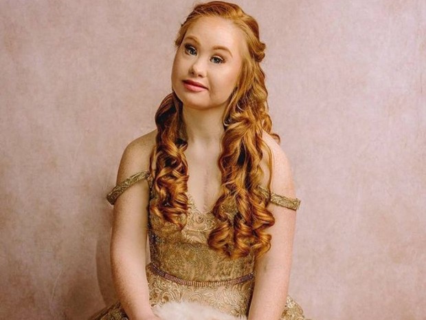 Kisah Madeline Stuart Supermodel Down Syndrome Dan Autisme Yang Jadi