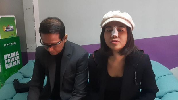 Klarifikasi Mayang soal keputusannya melakukan operasi hidung.