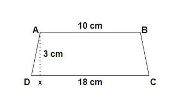 Begini Rumus Luas Trapesium dan Keliling Serta Contoh Soal
