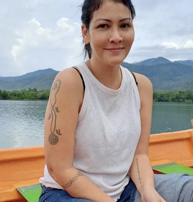 Selain Melaney Ricardo, 6 Selebritas Ini juga Jalani Operasi Angkat ...