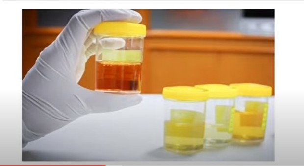 Waspada Fenomena Alam El Nino, Kenali 12 Tanda Tubuh Alami Dehidrasi ...