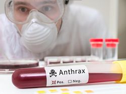 Berita dan Informasi Ciri ciri antraks pada manusia Terkini dan Terbaru ...