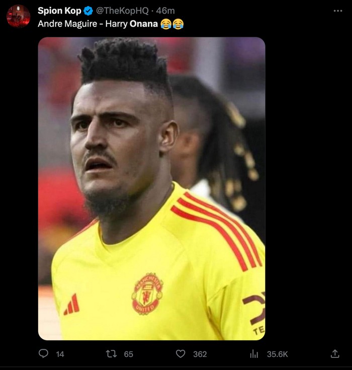 Bayern Munich Vs MU: Meme Kocak Andre Onana Rebahan Habis Blunder