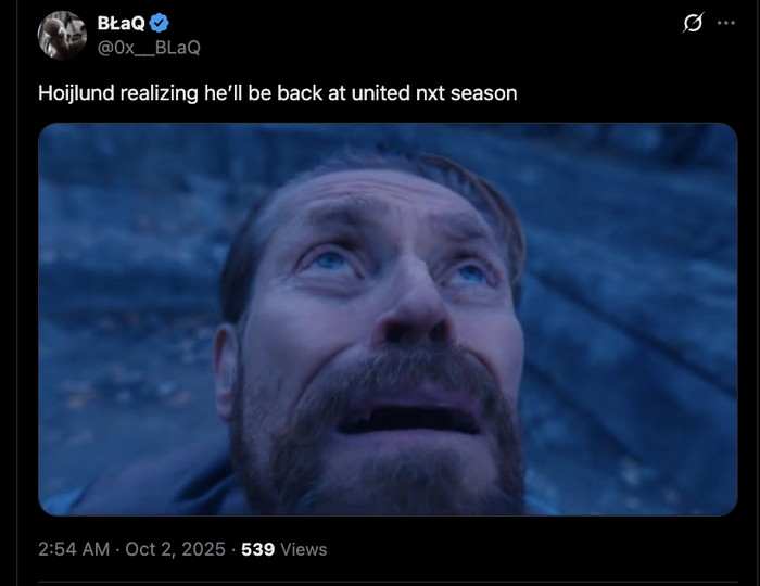 Meme Kocak MU Kena Ledek usai Rashford dan Hojlund Kontribusi Gol di UCL