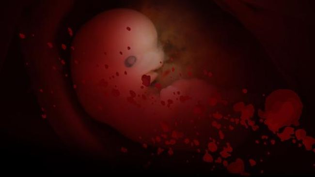 Tercatat Angka Aborsi Meningkat di Perkotaan