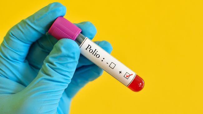 Vaksin Polio, Ini Waktu Tepat Diberikan pada Anak