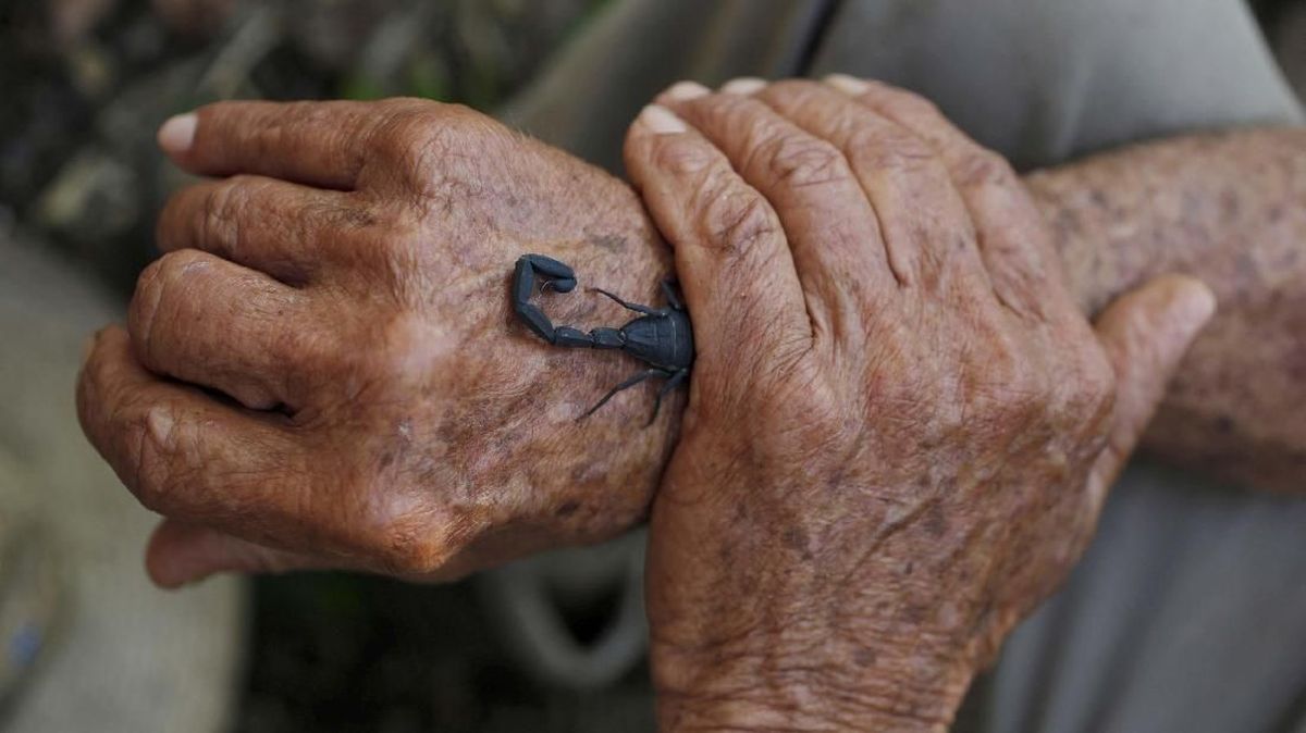 FOTO: Racun Sengatan Kalajengking Kuba yang Menyehatkan