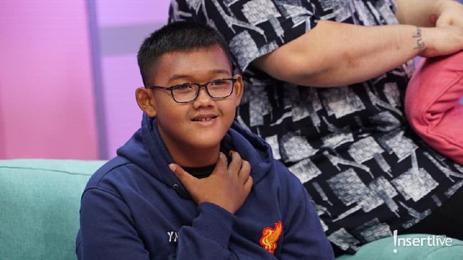 Selain Operasi Lambung, Ini Cara Arya Permana Turun 110 Kilogram