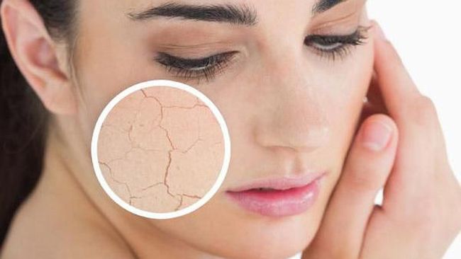 Produk Korea yang Cocok Untuk Kulit Kering