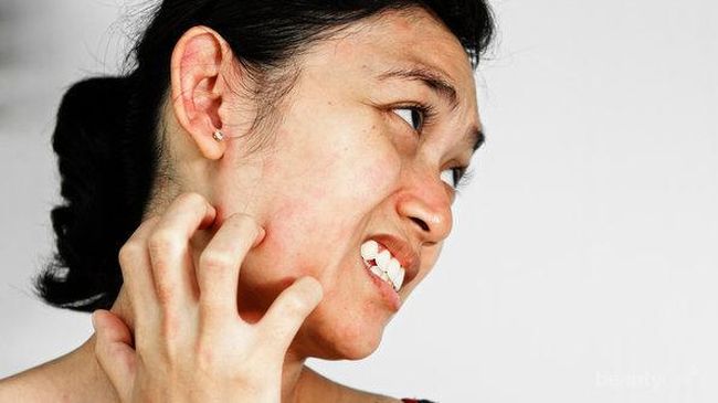 6 Cara Alami Mengatasi Biang Keringat Membandel