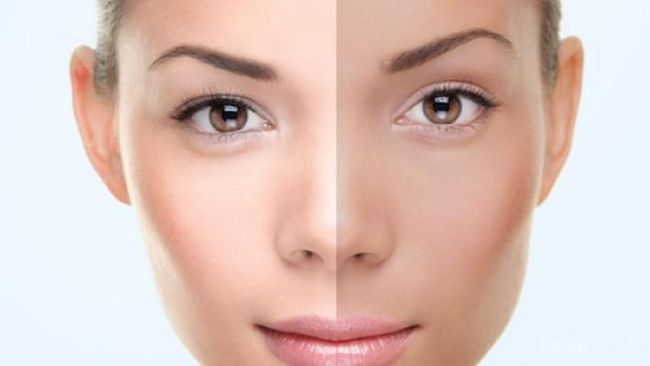 Yuk, Kontrol Melanin untuk Cerahkan Warna Kulit