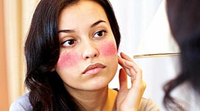 hati-hati makeup palsu bikin muka rusak!