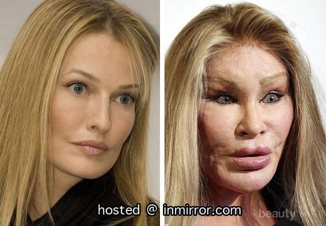 Duh, Begini Penampilan Sekarang Para Wanita yang Dulu Gagal Melakukan ...