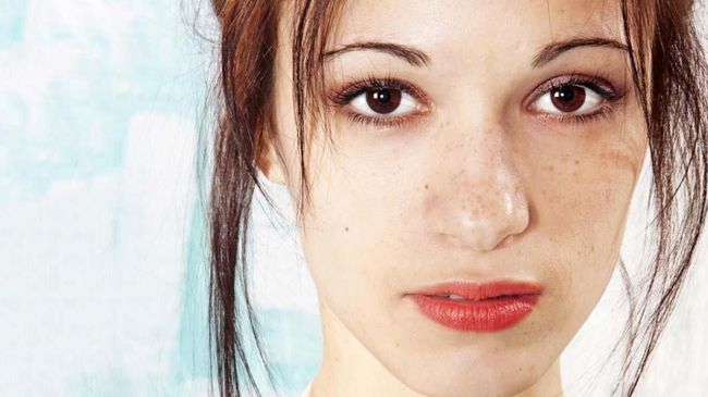 Terungkap! Ternyata Inilah Penyebab Flek Hitam di Wajah