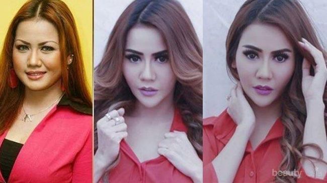 Mengejutkan! 10 Wajah Artis Ini Berubah Drastis Setelah Operasi Plastik
