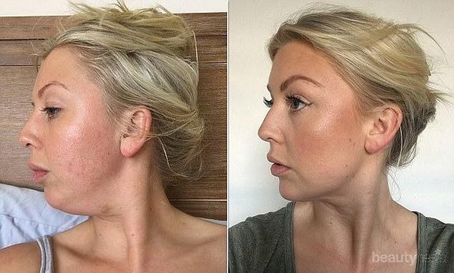 Dari Make Up Hingga Gaya Rambut, Ikuti Trik Ini Agar Double Chin Hilang ...