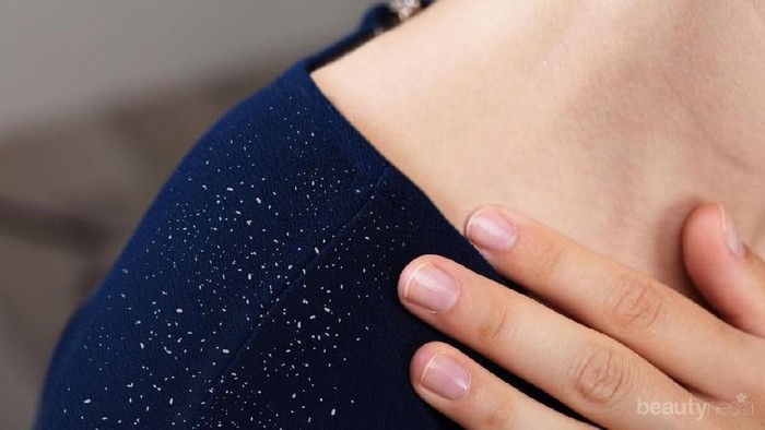 Yuk Ketahui Jenis-Jenis Ketombe dan Cara Mengatasinya di Sini