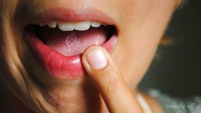 Cegah Bibir Kering Saat Puasa dengan Vaseline Petroleum Jelly