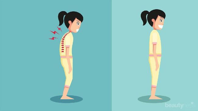 Cara Memperbaiki Postur Tubuh agar Tetap Tegak, Simak Rahasianya!
