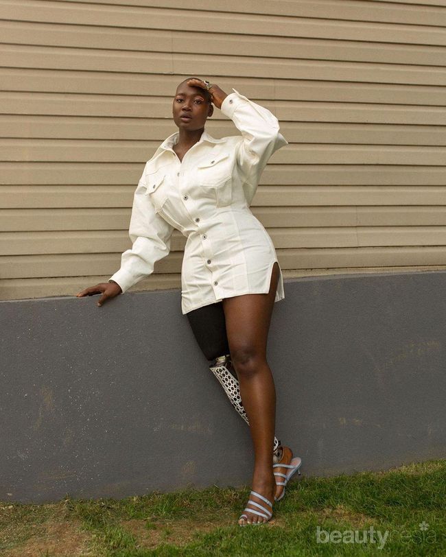 Fakta Mama Cax, Model Tanpa Kaki yang Tutup Usia karena Kanker Tulang