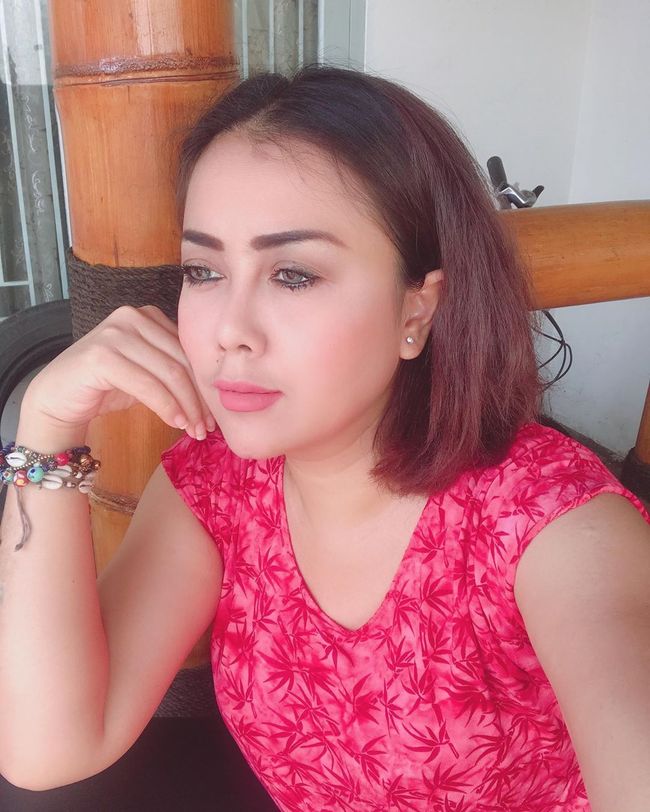 Artis Rency Milano Jadi Korban Malapraktik, Sesalkan Klinik dengan ...