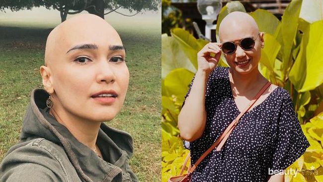 Foto: Feby Febiola dengan Kepala Plontos, Tetap Cantik & Memesona - Foto 1