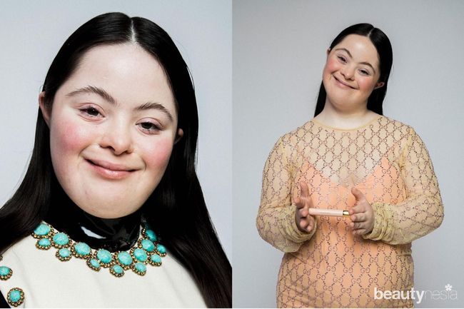 Ellie Goldstein, Model Cantik dari Gucci Beauty yang Istimewa